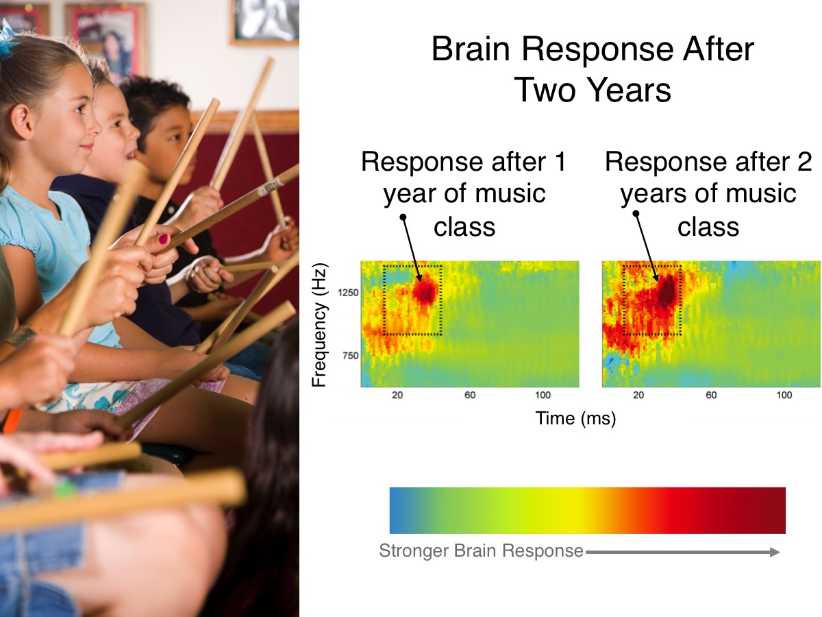 Music Training and Speech Sound Processing | Institute for Learning and ...